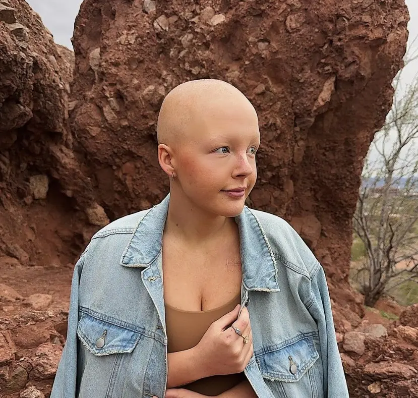 Morre Maddy Baloy, influencer que compartilhou batalha contra o câncer ...