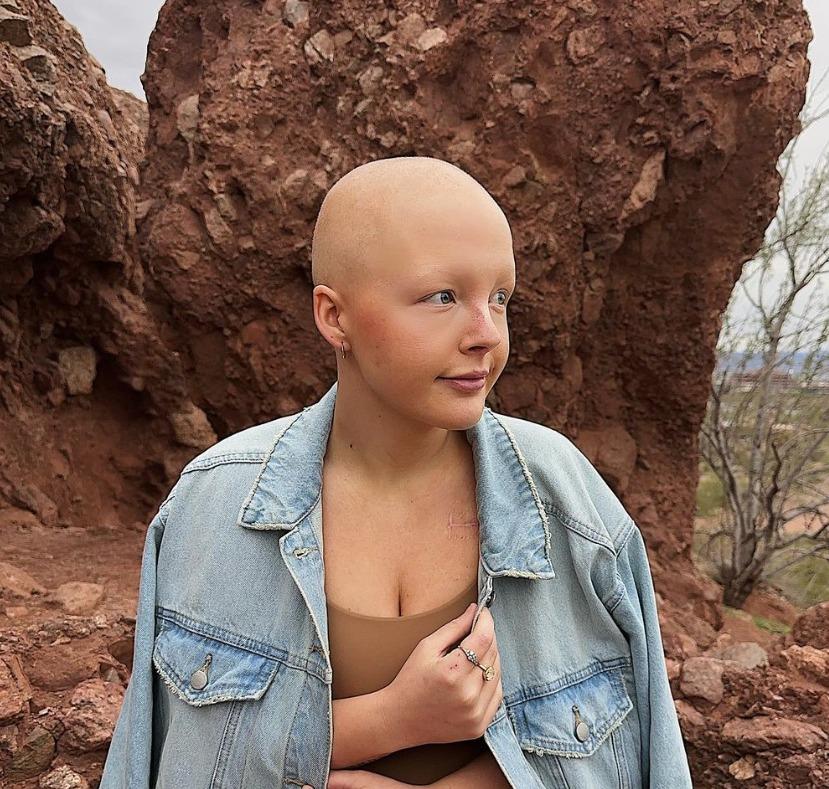 Morre Maddy Baloy, influencer que compartilhou batalha contra o câncer ...